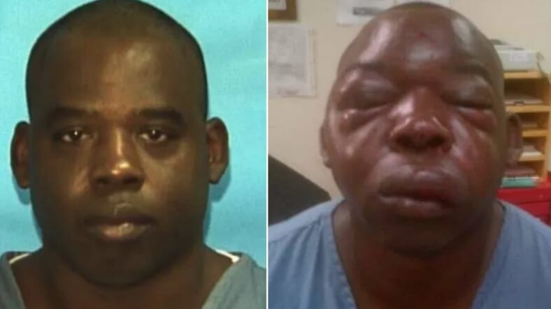 Prison guard allegedly beat Black inmate for wanting to marry a white ...